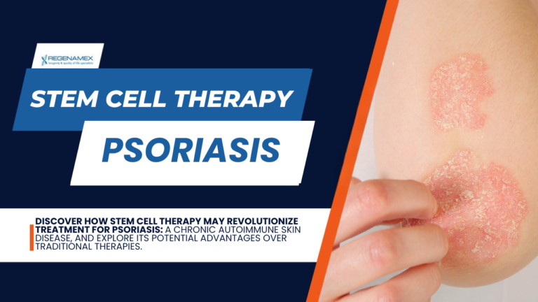 Exploring Stem Cell Therapy for Psoriasis: Innovations and Insights ...