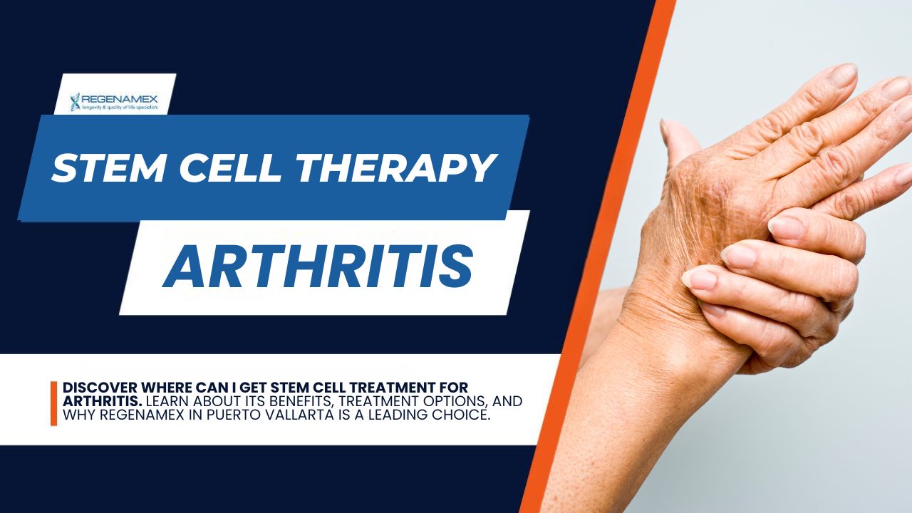 Where Can I Get Stem Cell Treatment for Arthritis? - Stem Cell Clinic ...